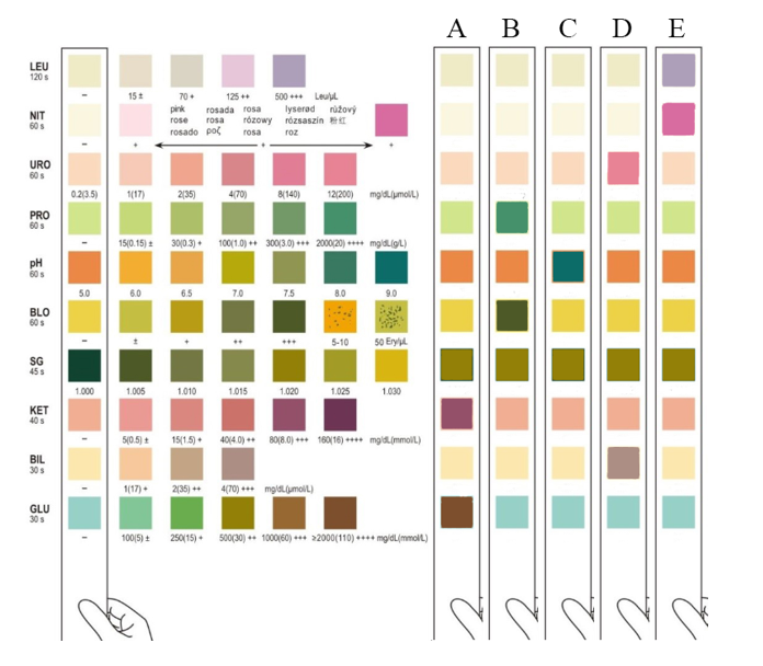 Solved Chemical Analysis of Pathological Urine Compare the | Chegg.com