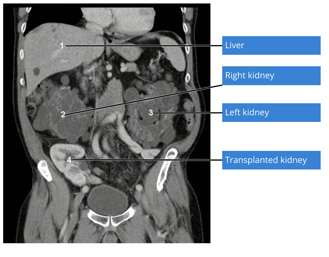 Solved Label the features on this still image from Dr | Chegg.com