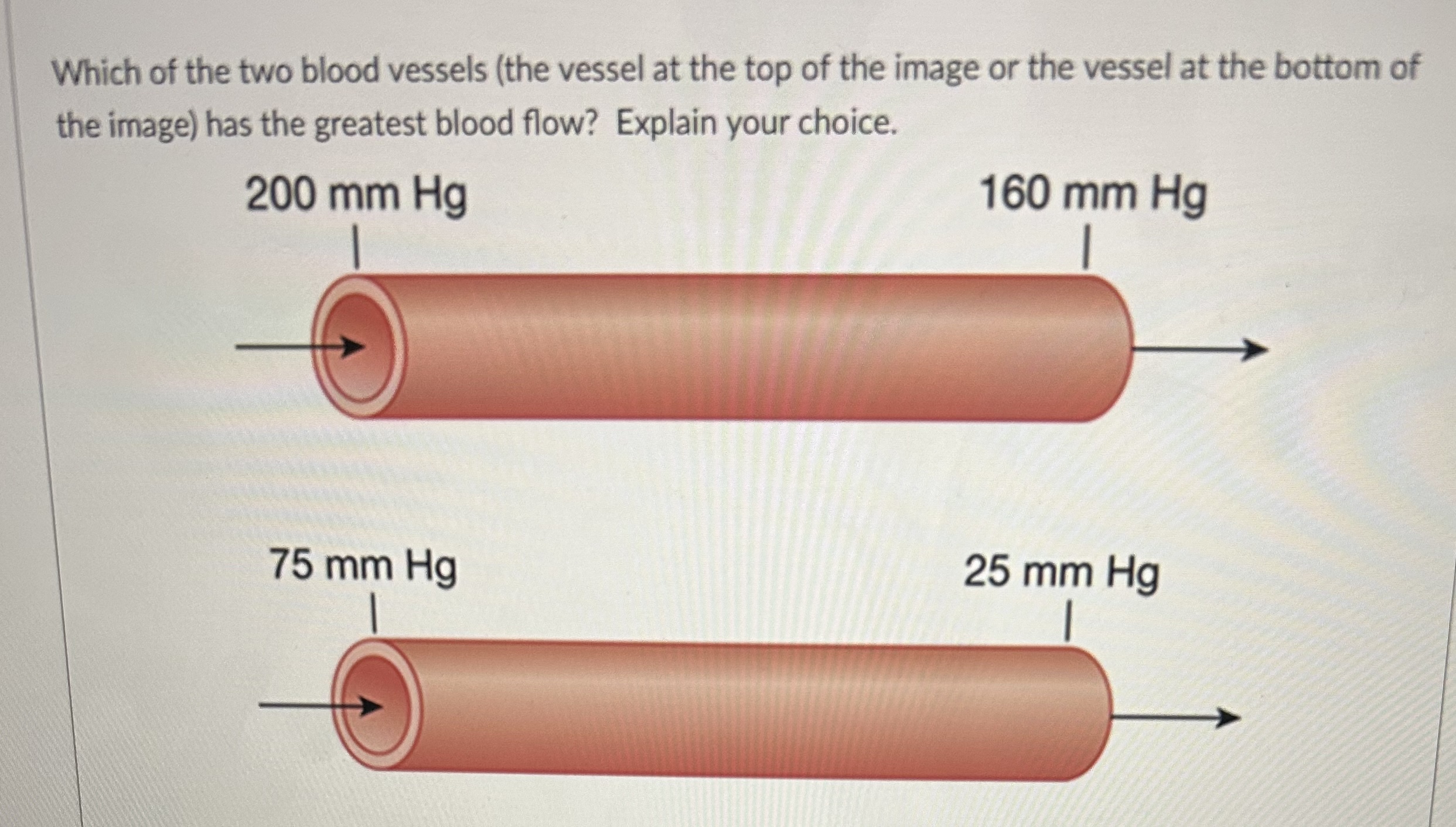 Solved Which of the two blood vessels (the vessel at the top | Chegg.com
