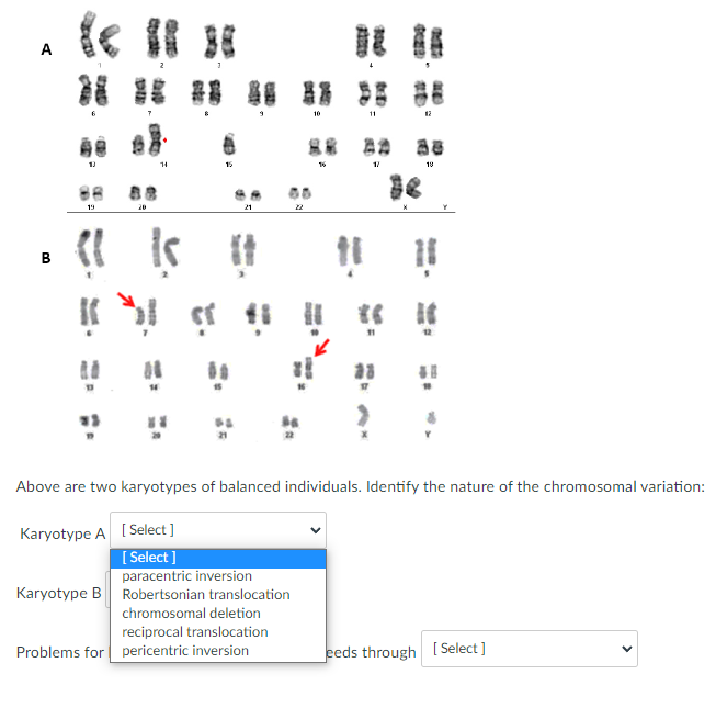 Solved Above are two karyotypes of balanced individuals. | Chegg.com