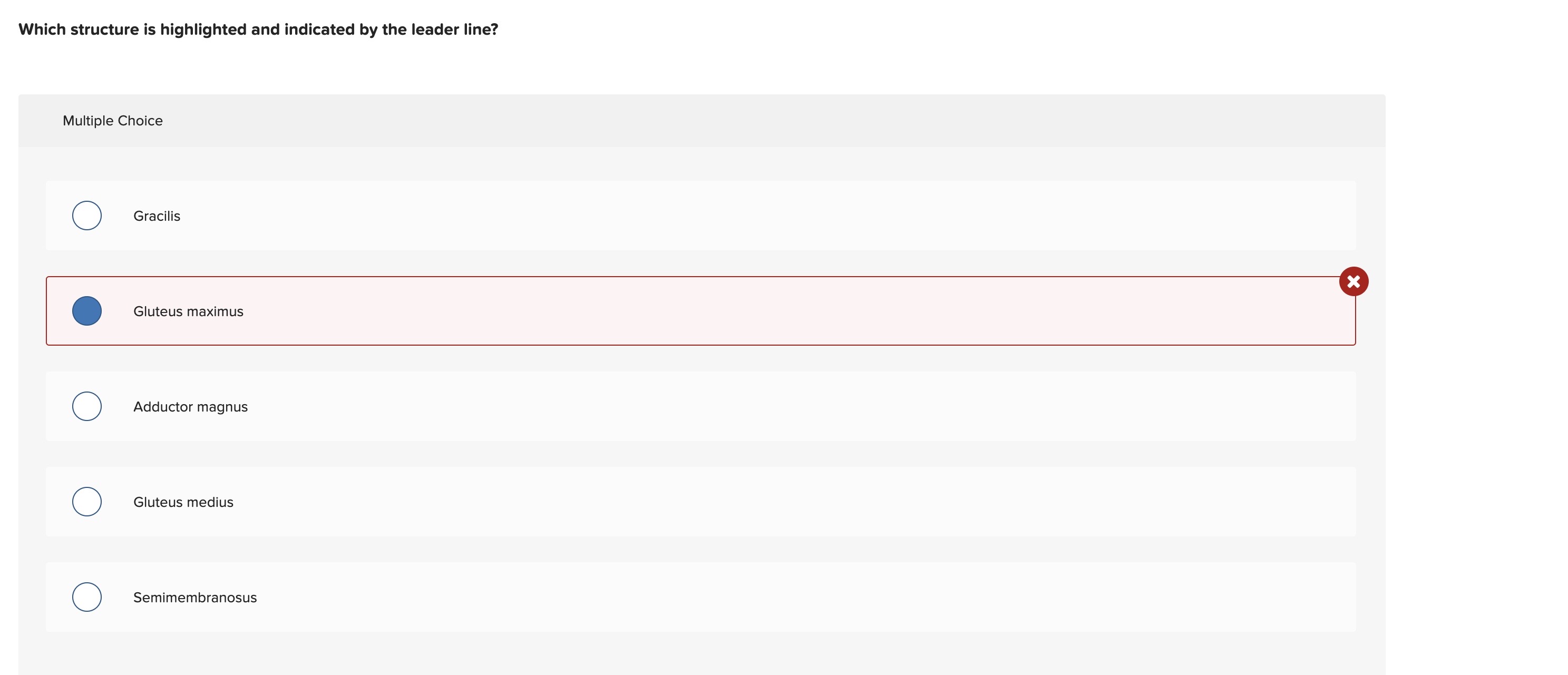 Solved APR photo (c) McGraw-Hill Education Which structure | Chegg.com