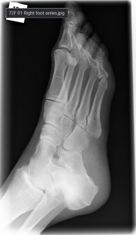 Solved 72F 01 Right foot series.jpg | Chegg.com