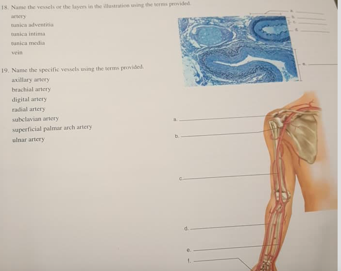 Solved 18. Name the vessels or the layers in the | Chegg.com