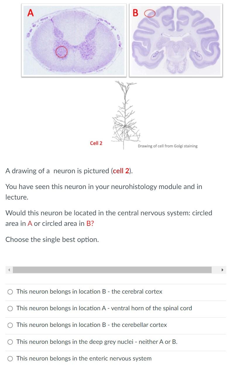 Solved A B Cell 2 Drawing of cell from Golgi staining A | Chegg.com