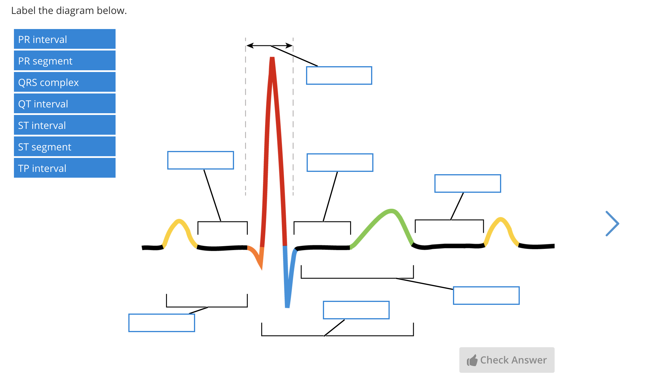 Solved Label the diagram below. PR interval PR segment QRS | Chegg.com