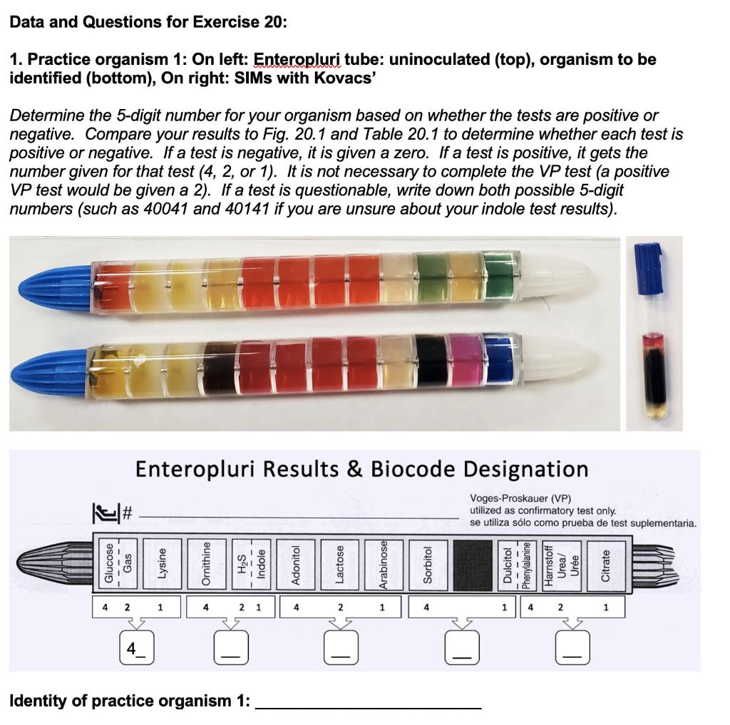Solved Example organism: On left: Enteropluri tube: | Chegg.com