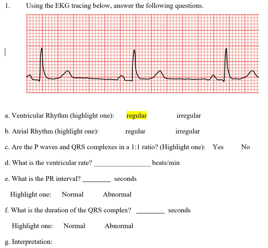 Solved 1. Using the EKG tracing below, answer the following | Chegg.com