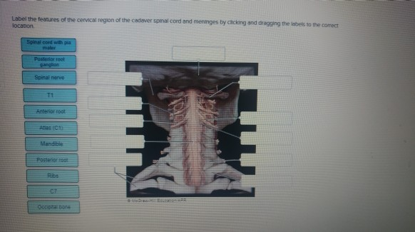 Solved Label the features of the cervical region of the | Chegg.com