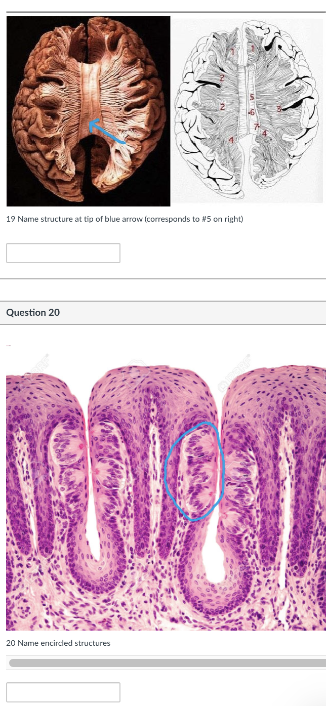 Solved 19 Name structure at tip of blue arrow (corresponds | Chegg.com