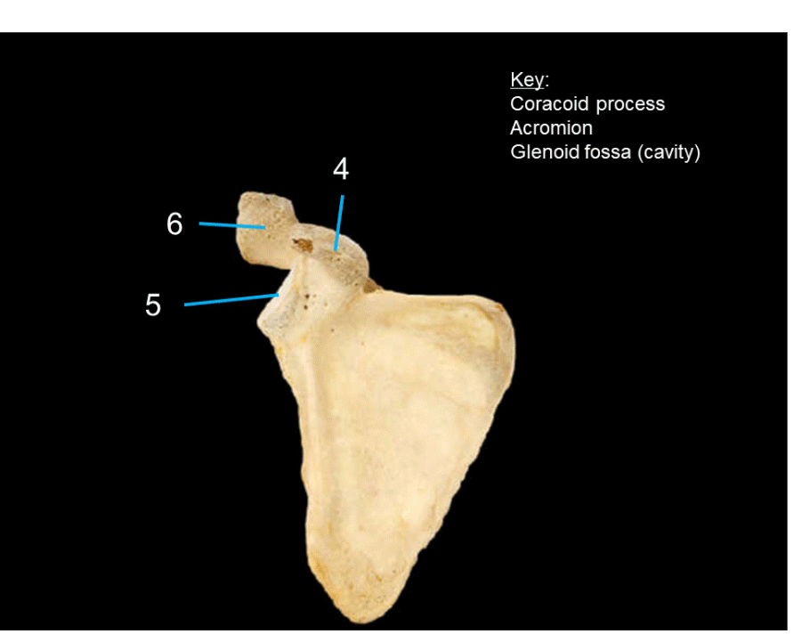 Solved Key: Coracoid process Acromion Glenoid fossa (cavity) | Chegg.com