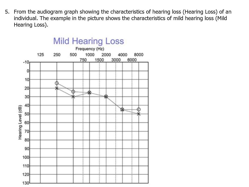 5. From the audiogram graph showing the | Chegg.com