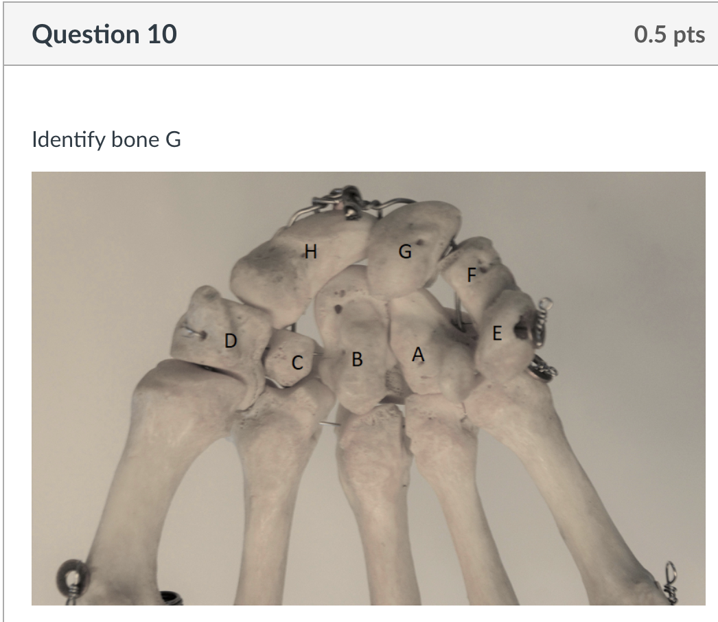 Solved Identify bone G | Chegg.com