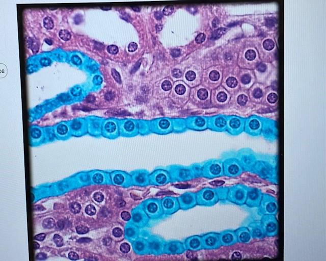 Solved What is this? Simple cuboidal epithelium Connective | Chegg.com