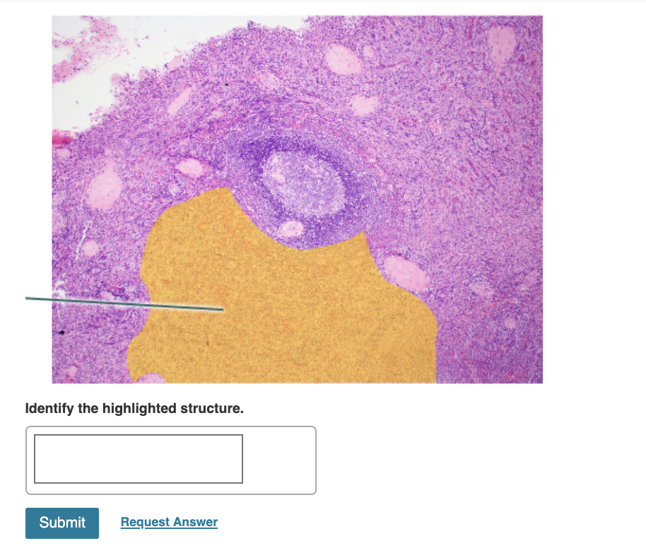 Solved Identify the highlighted structures. Submit Request | Chegg.com Solved Identify the highlighted structures. Submit Request | Chegg.com