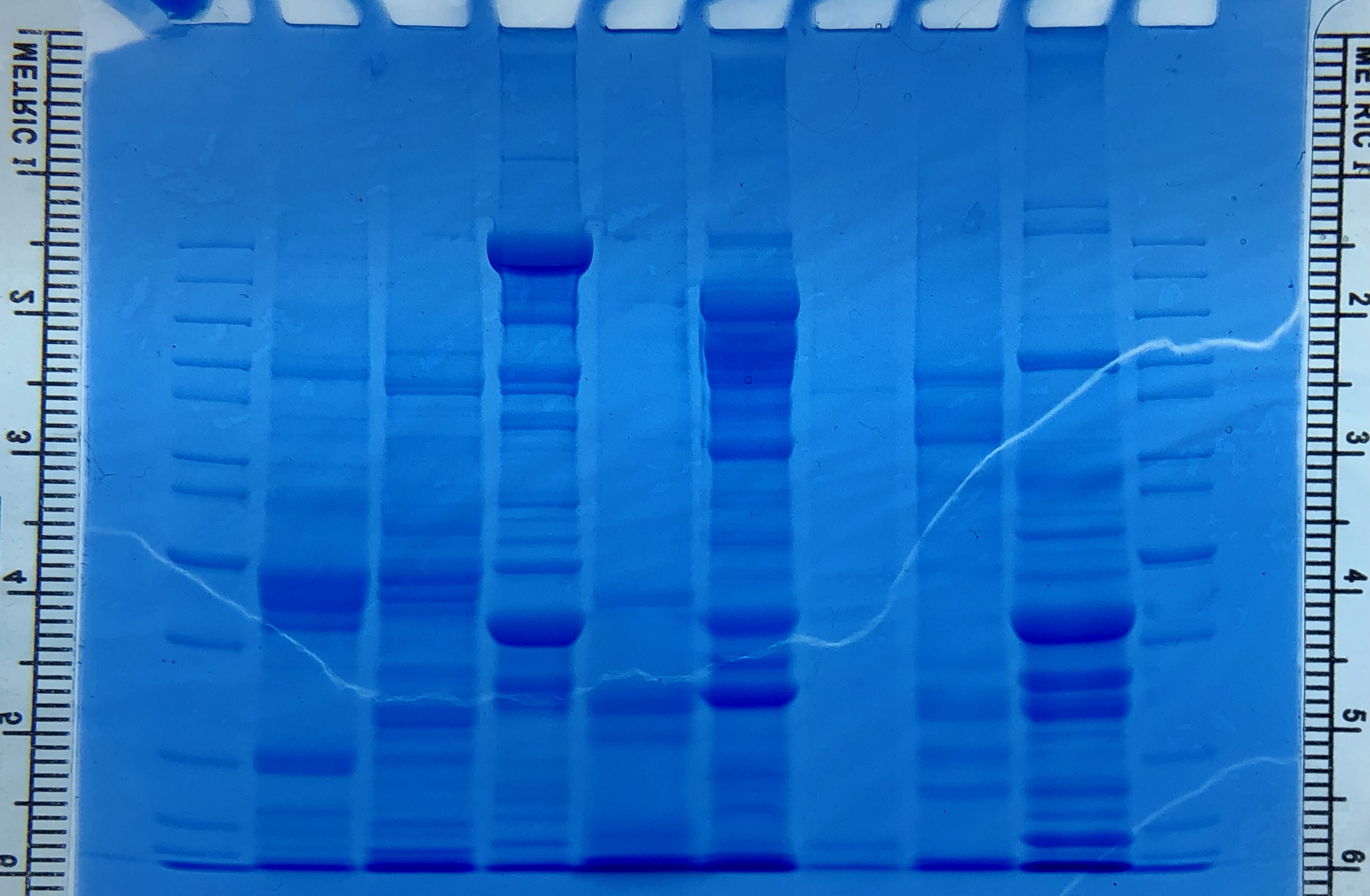 The first image is the gel that you have to use. | Chegg.com