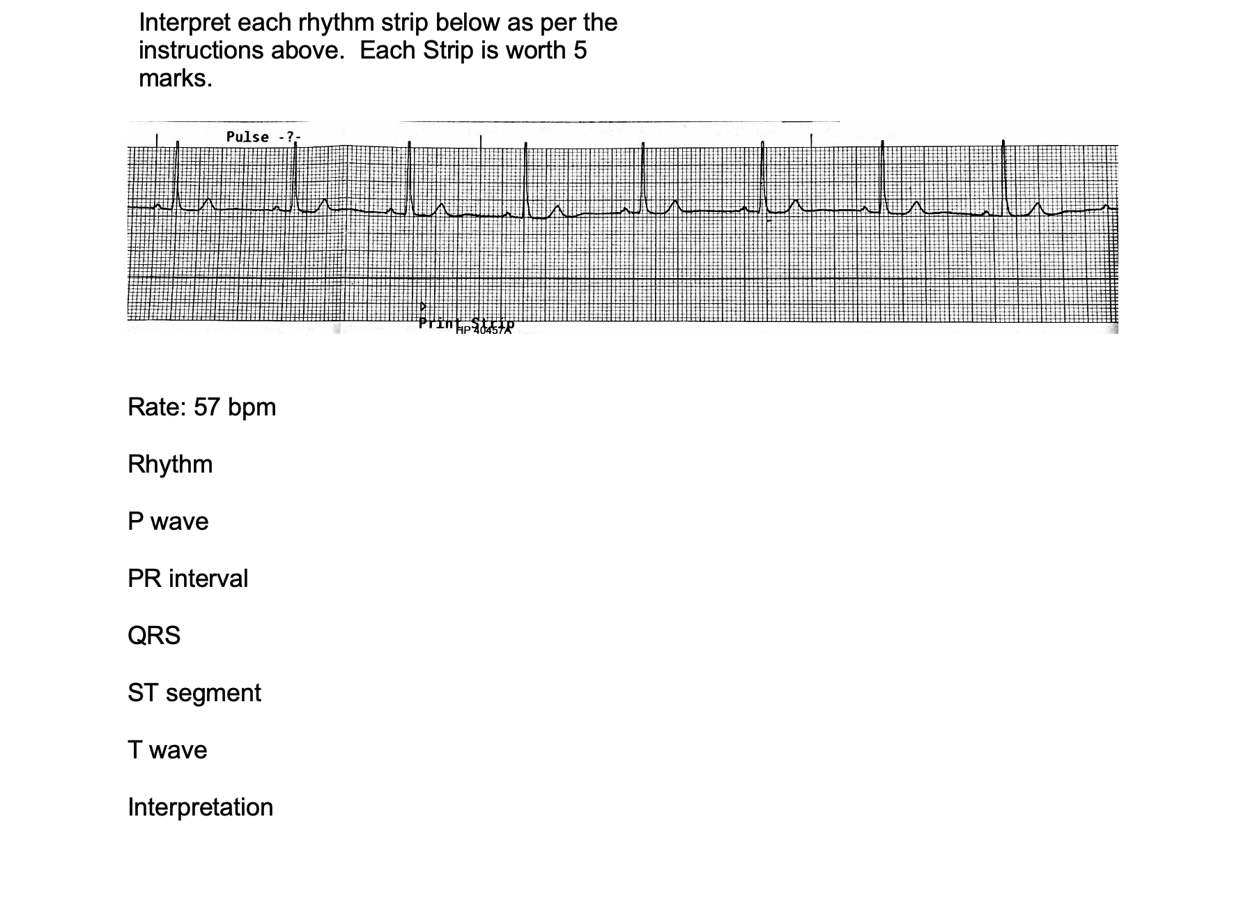 Solved Interpret each rhythm strip below as per | Chegg.com