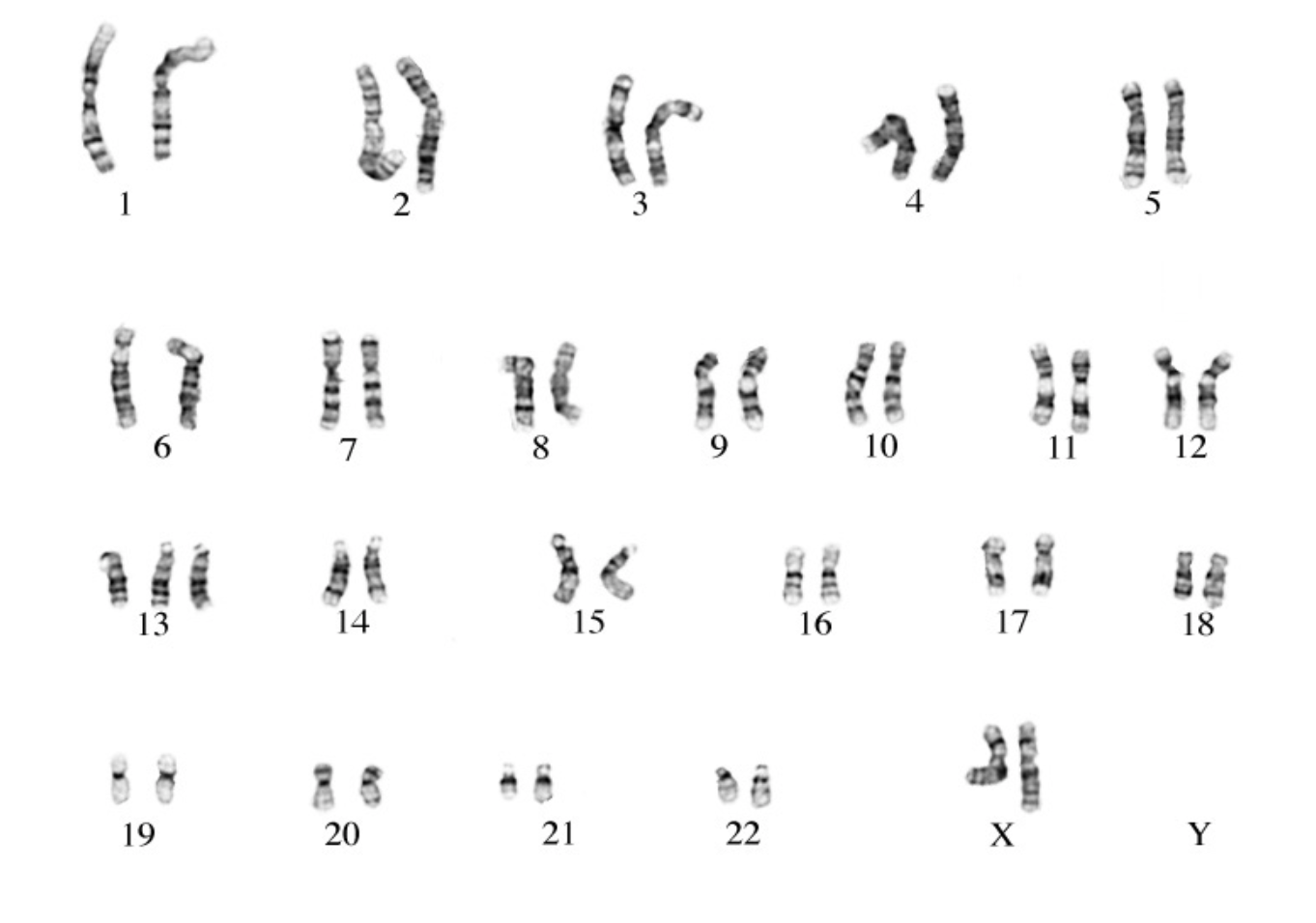 Solved This karyotype can best be described as: | Chegg.com