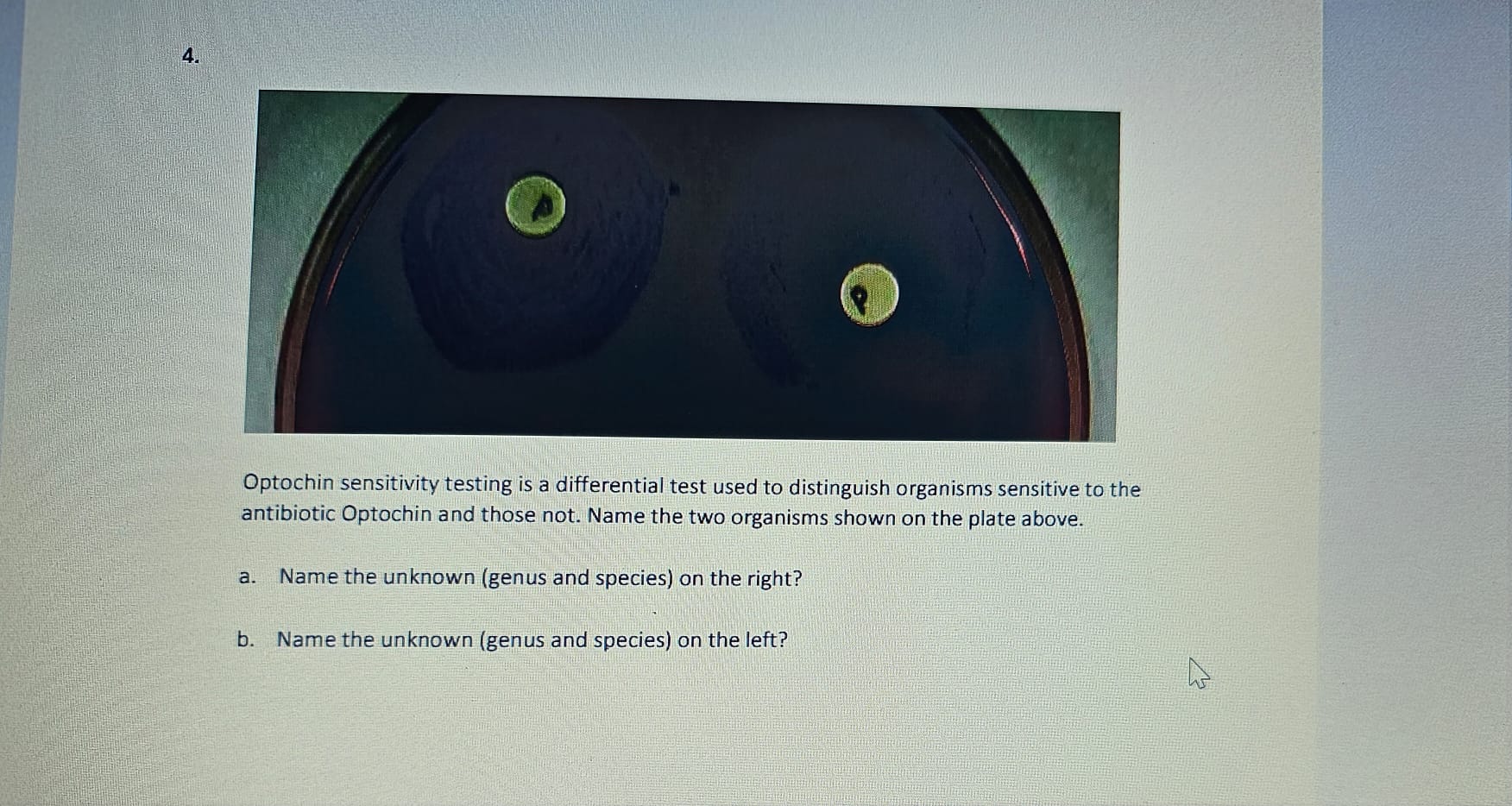 Solved Optochin sensitivity testing is a differential test | Chegg.com