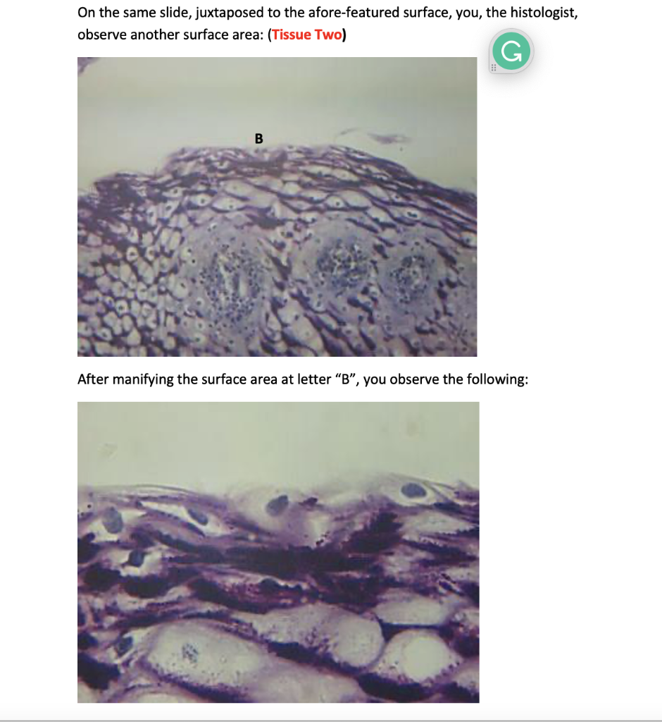 Solved Histology Assignment You, the histologist, observe a | Chegg.com Solved Histology Assignment You, the histologist, observe a | Chegg.com