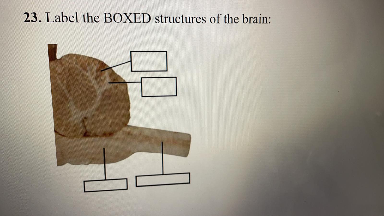 Solved 23. Label the BOXED structures of the brain: 24. | Chegg.com