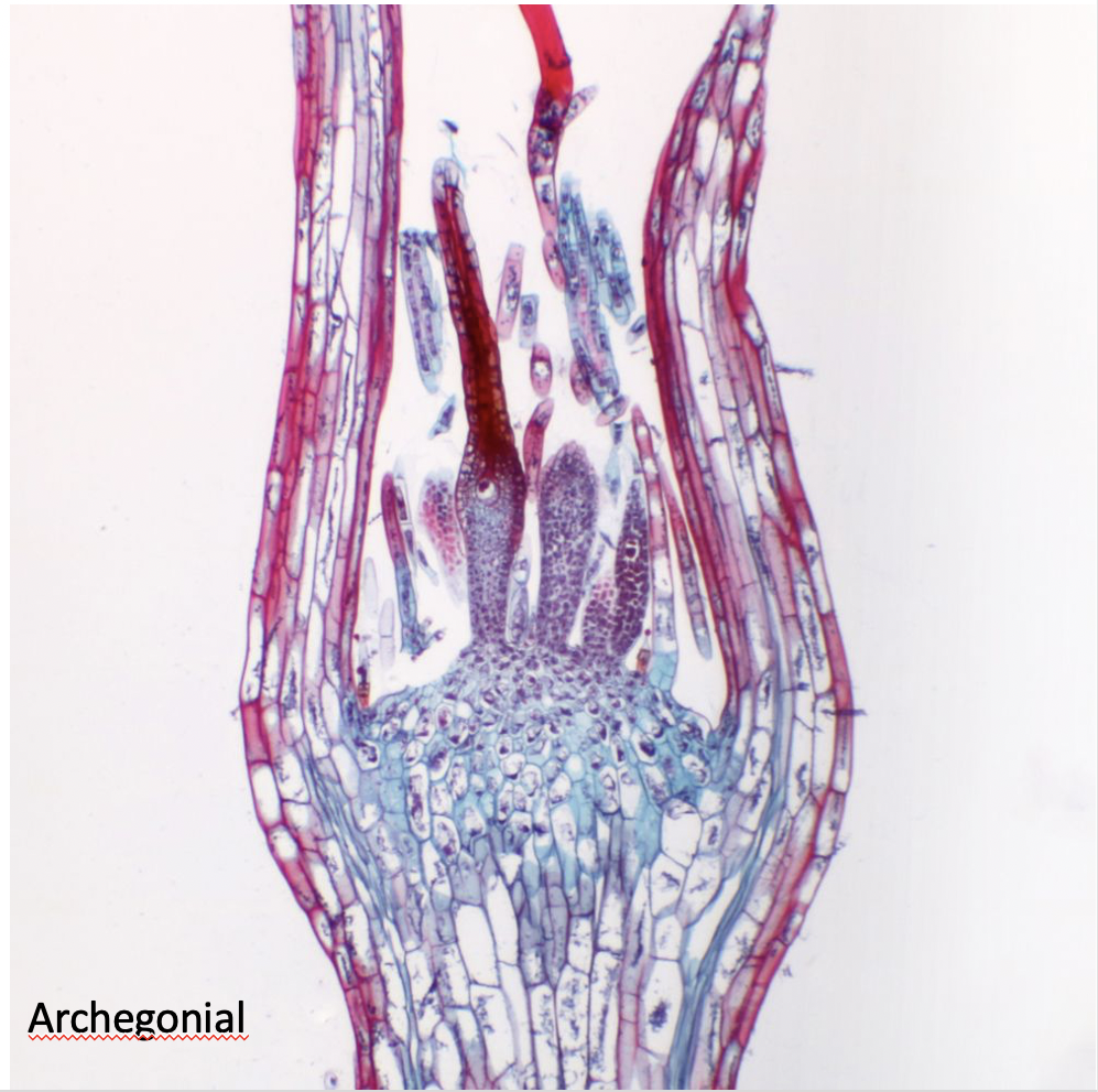 Solved Observe the Moss Antheridial Head & Moss Archegonial | Chegg.com