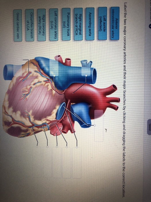 Solved Saved Label the two major coronary arteries and their | Chegg.com
