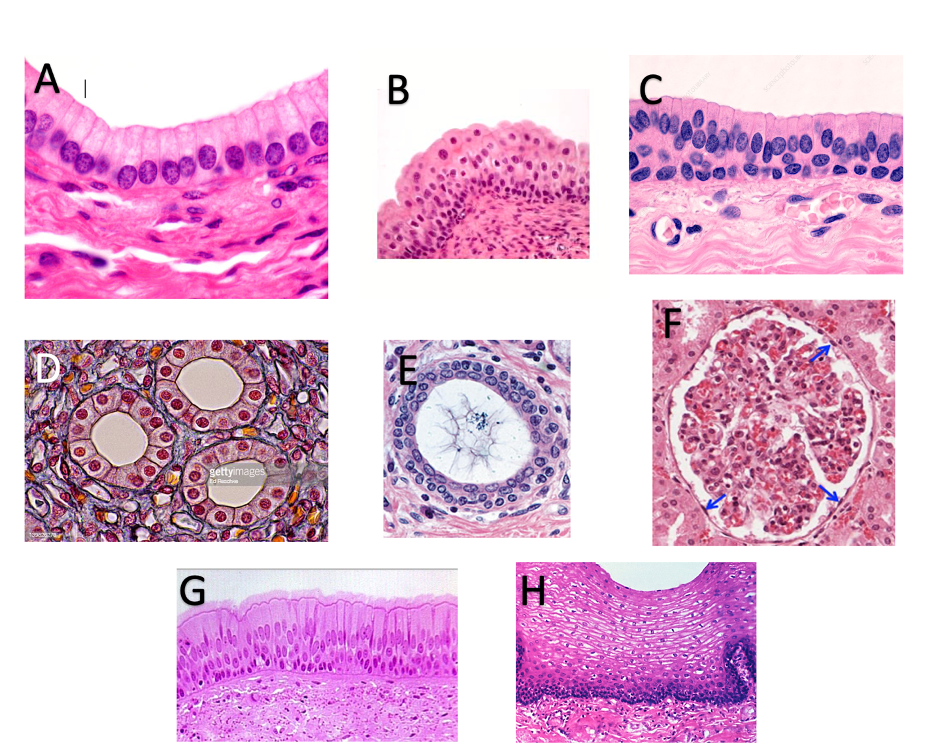 Solved Simple Epithelia:Simple SquamousSimple CuboidalSimple | Chegg.com