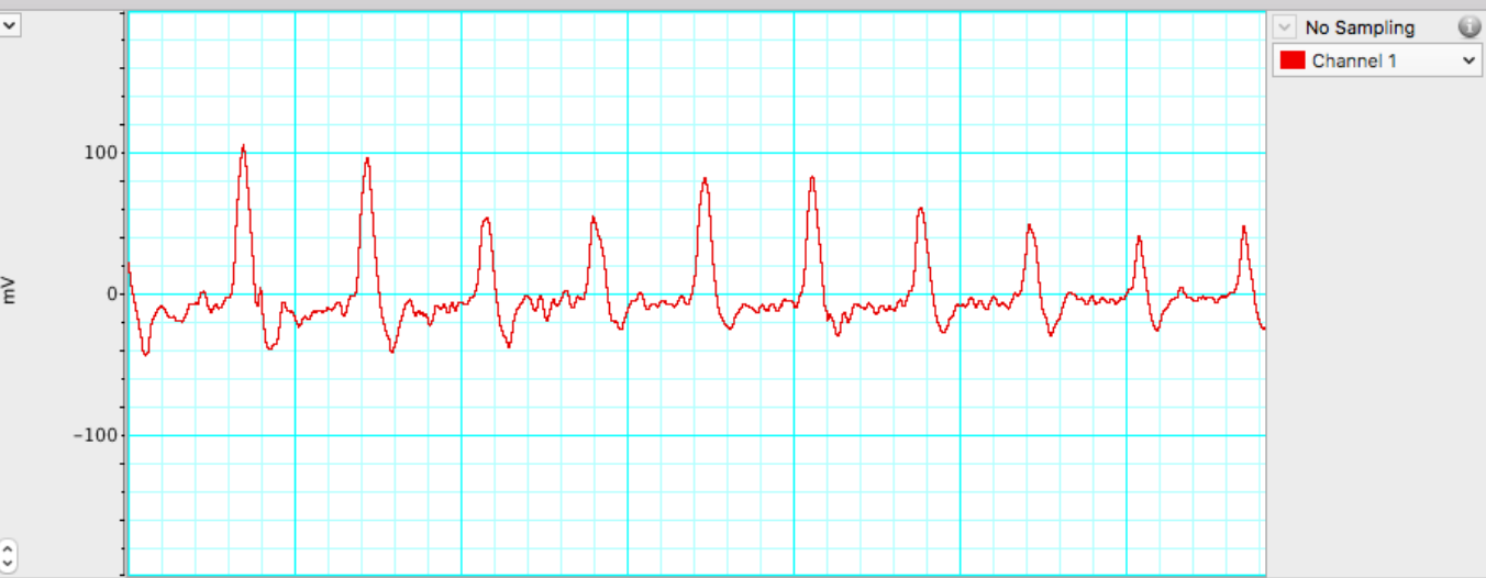 Solved Using your data from topic 1 (DAS) use labchart | Chegg.com Solved Using your data from topic 1 (DAS) use labchart | Chegg.com