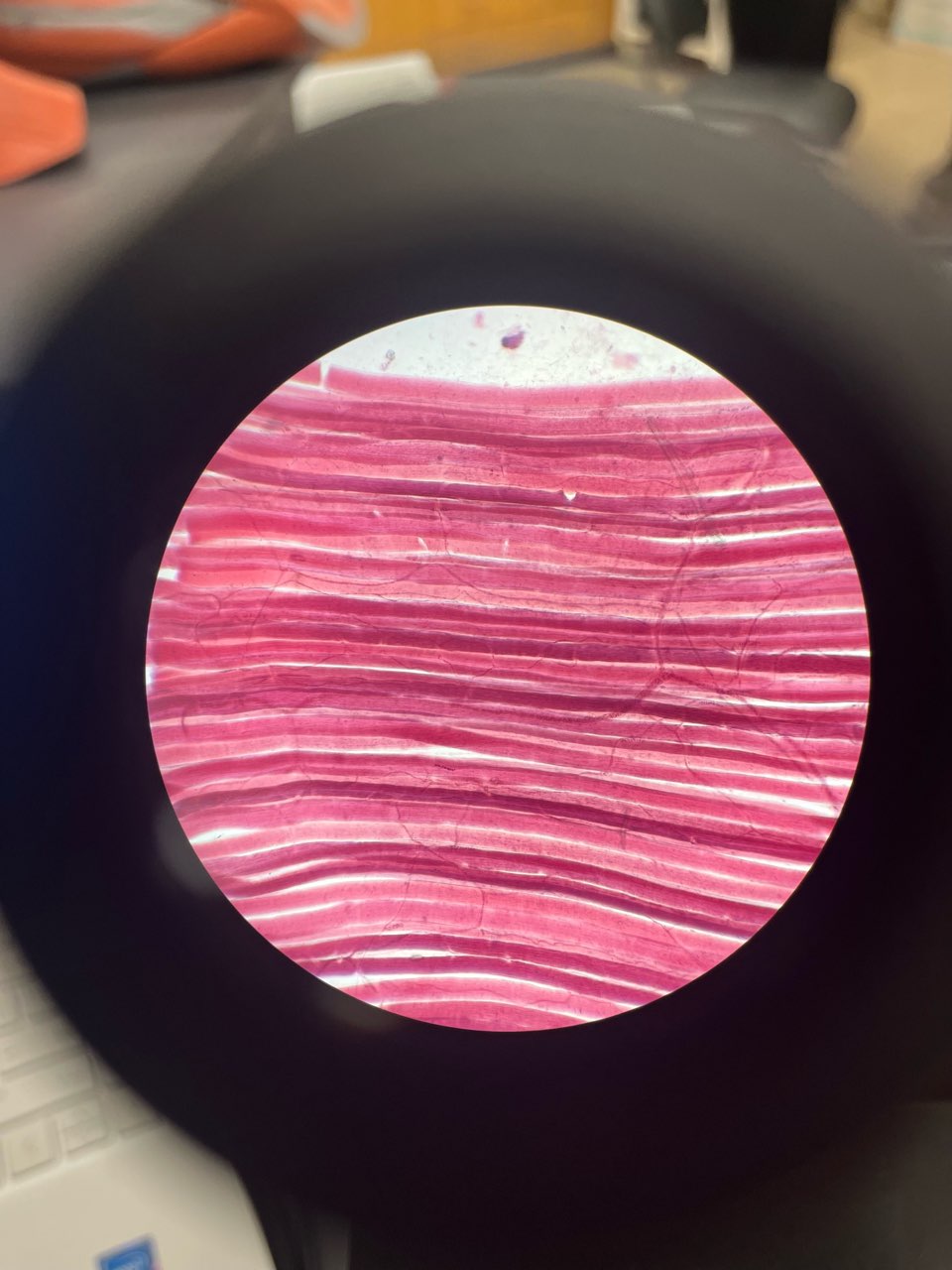 Solved The picture attached is a Neuromuscular Junction | Chegg.com