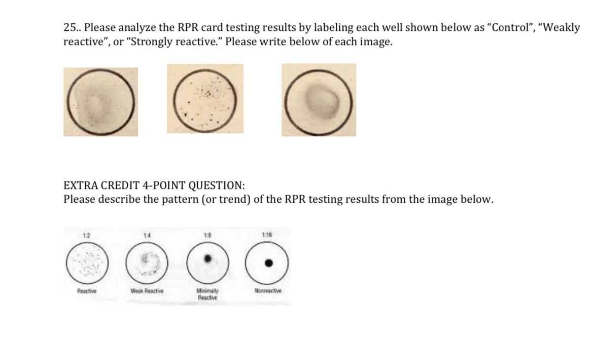 Solved 25.. Please analyze the RPR card testing results by | Chegg.com