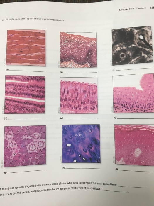 Solved 22. Write the name of the specific tissue type below | Chegg.com
