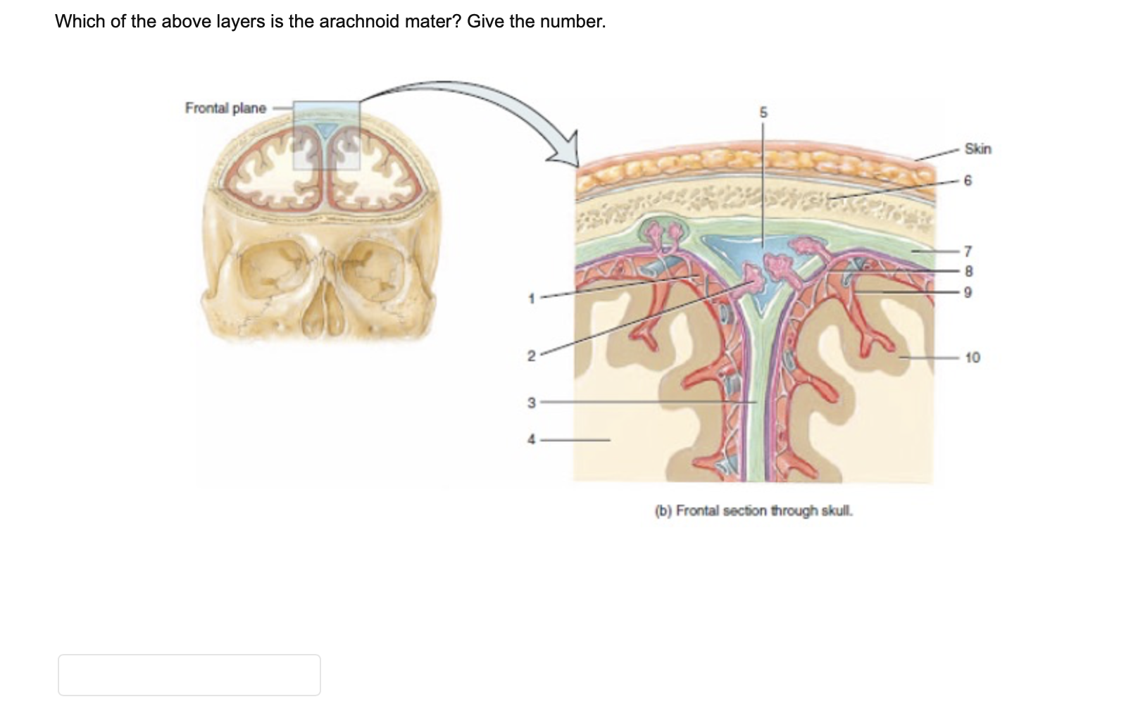 Solved Which Of The Above Layers Is The Arachnoid Mater
