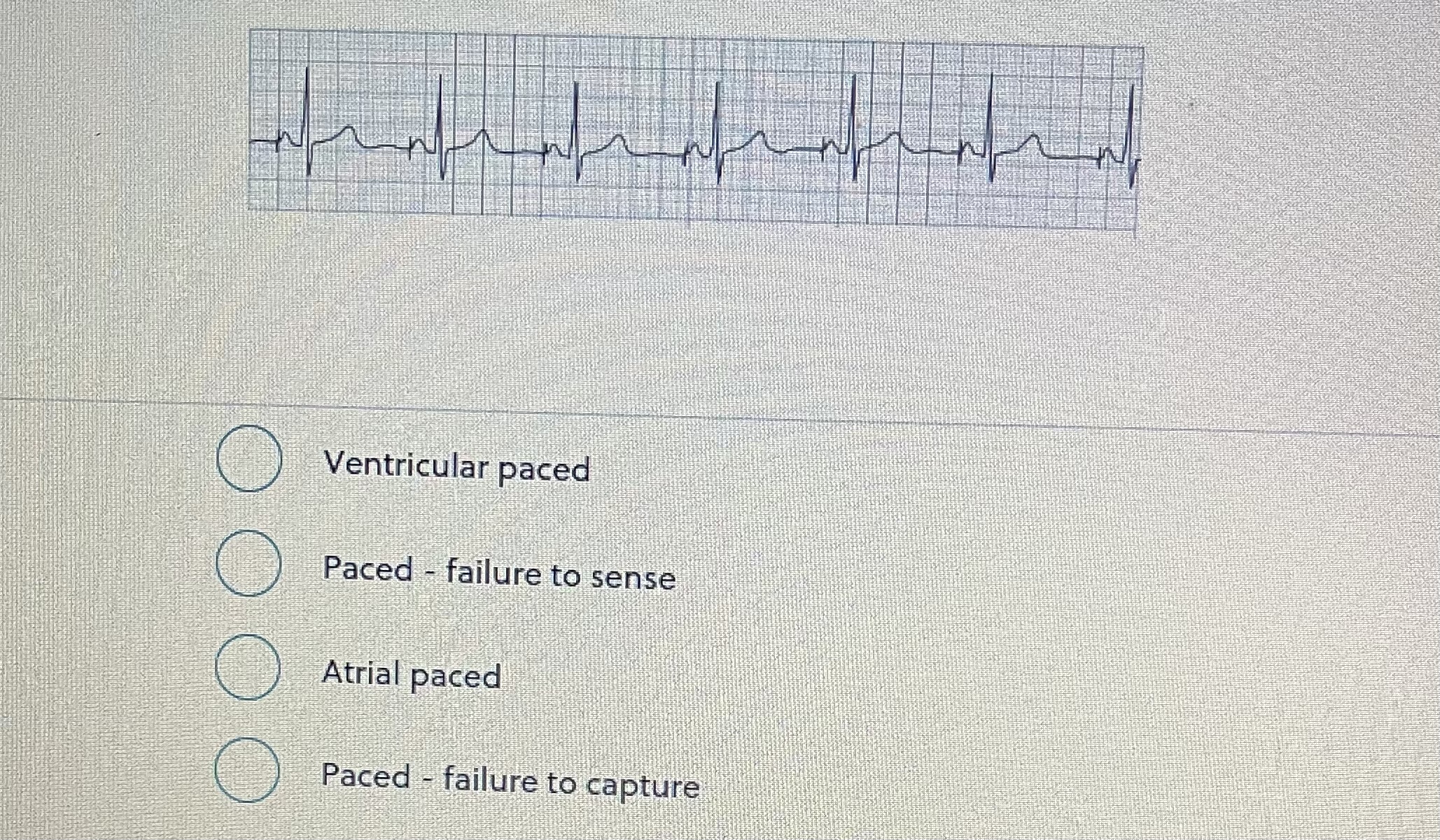 Solved Ventricular paced Paced - failure to sense Atrial | Chegg.com