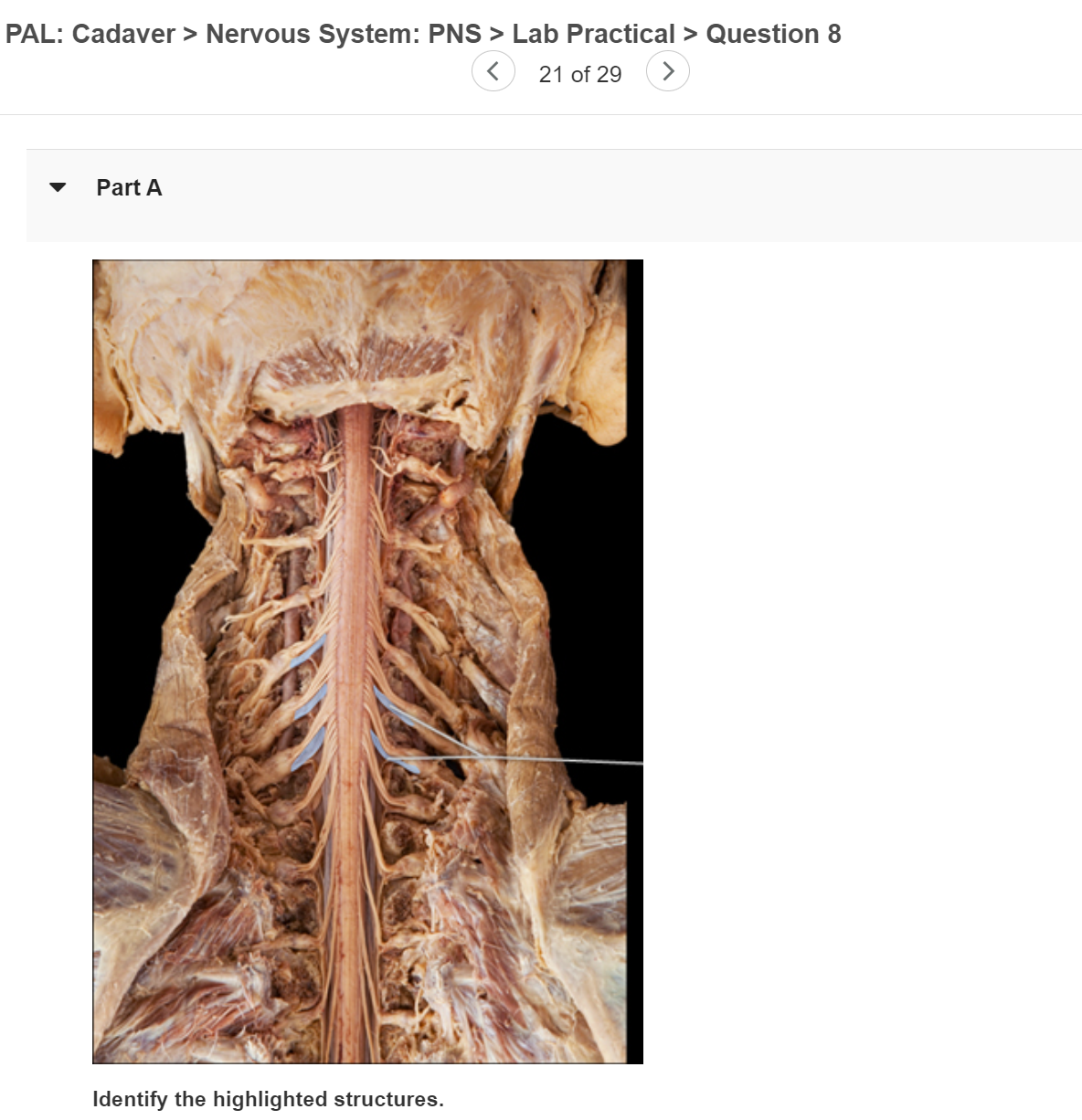 Solved PAL: Cadaver > Nervous System: PNS > Lab Practical > | Chegg.com