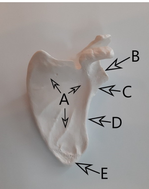 Solved The structure indicated by "A" issuperior angleThe | Chegg.com