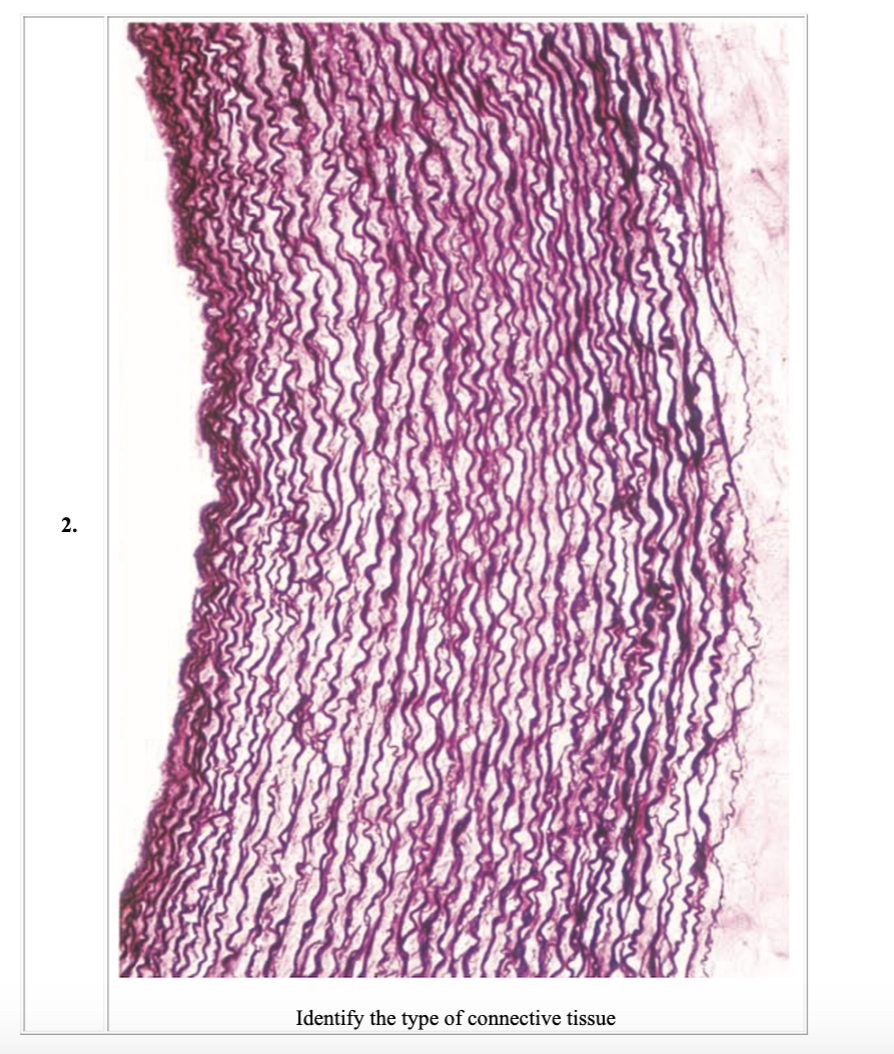 Solved Identify the type of connective tissue | Chegg.com Solved Identify the type of connective tissue | Chegg.com