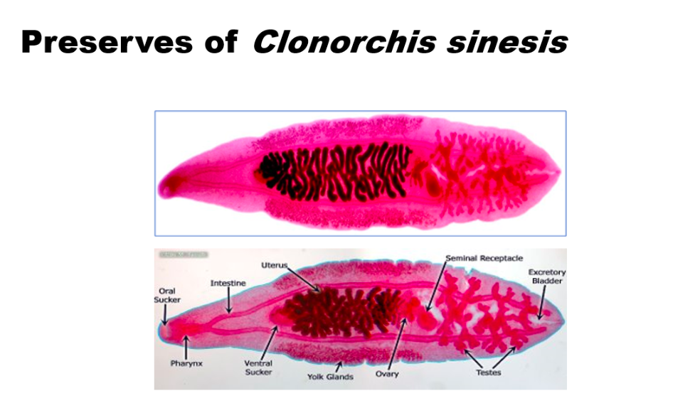 Clonorchis Sinensis Egg Slide