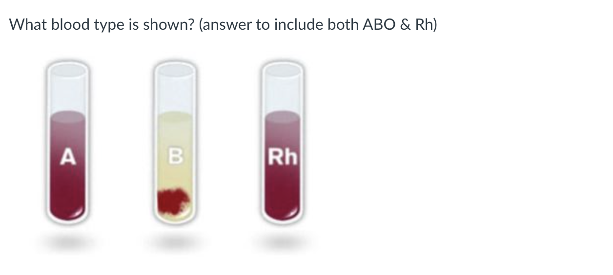 Solved What blood type is shown? (answer to include both ABO | Chegg.com