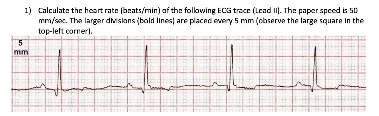 Solved 1) Calculate the heart rate (beats/min) of the | Chegg.com