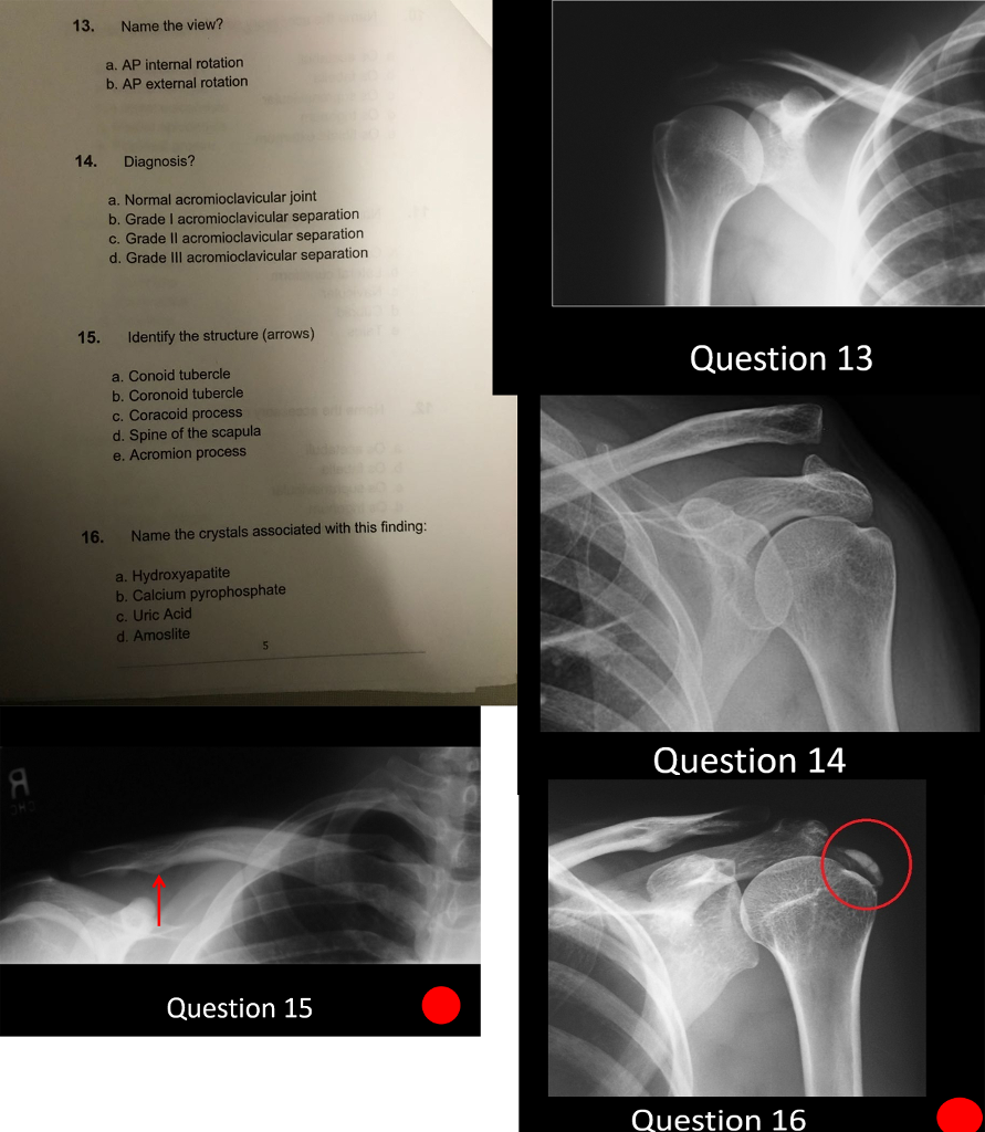 Solved 13. Name the view? a. AP internal rotation b. AP | Chegg.com