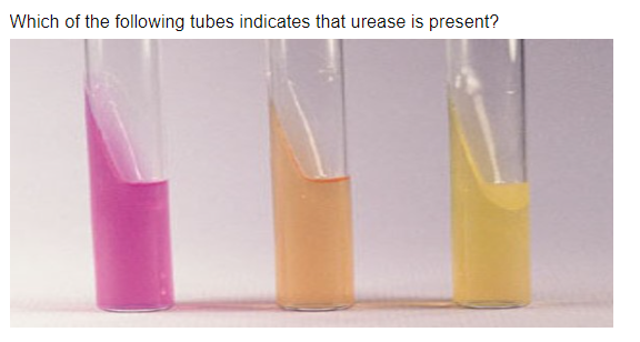 Solved Which of the following tubes indicates that urease | Chegg.com