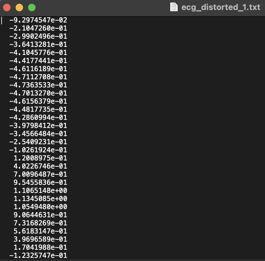 Solved 1) An ECG signal x is processed by an LTI system H | Chegg.com
