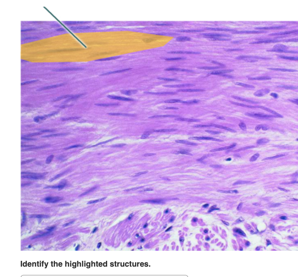 Solved Identify the highlighted structures. | Chegg.com Solved Identify the highlighted structures. | Chegg.com