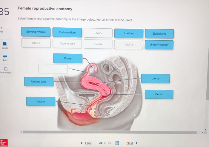 Solved 35Famale reproductive anatomy Label female | Chegg.com
