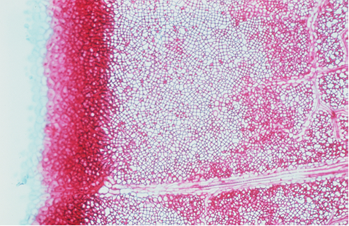Solved Paradermal section of a mesophytic Eudicot | Chegg.com