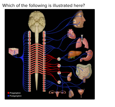 Solved Which of the following is illustrated here? | Chegg.com