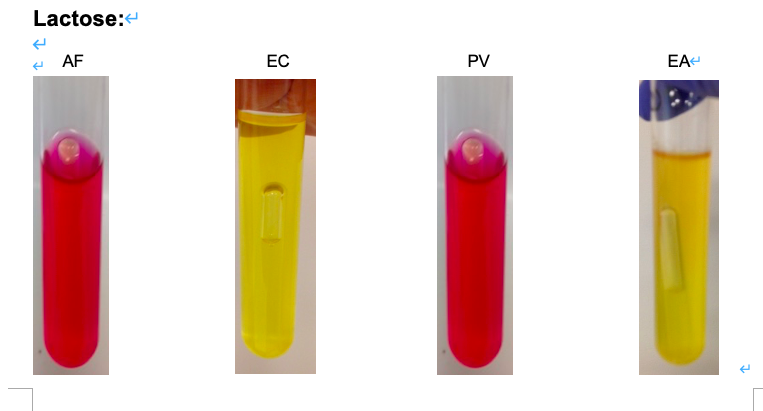 Solved Carbohydrate fermentation tubes: Inoculate each | Chegg.com