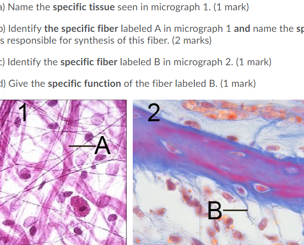 Solved a) Name the specific tissue seen in micrograph 1. (1 | Chegg.com