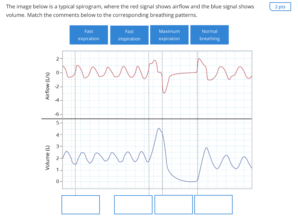 Solved 2 pts The image below is a typical spirogram, where | Chegg.com