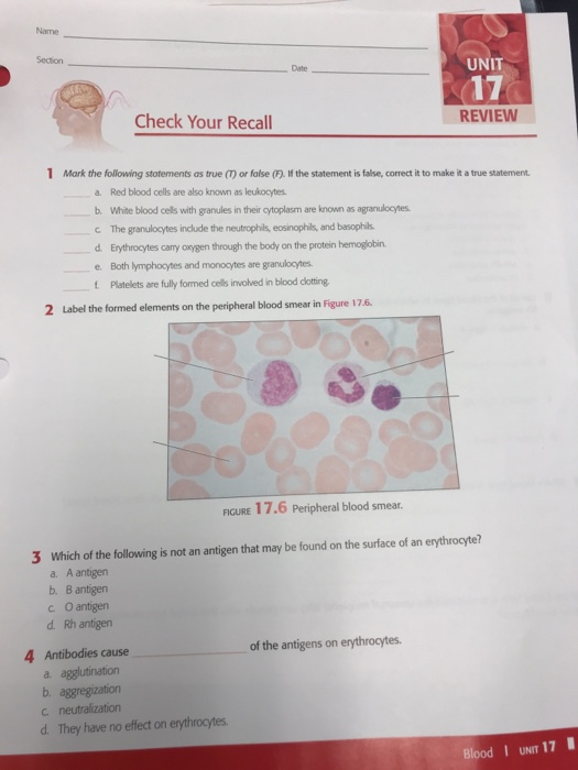 Solved Name Section UNIT 17 REVIEW Date Check Your Recall 1 | Chegg.com